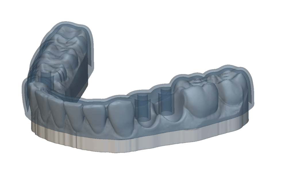 Training Guide: Dental Splints and Surgical Stents – nTop Learn